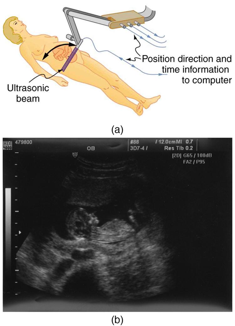 17.7 Ultrasound | Texas Gateway